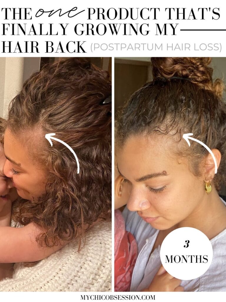 Stunning Jamaican Black Castor Oil For Hair Growth Before And After Photos